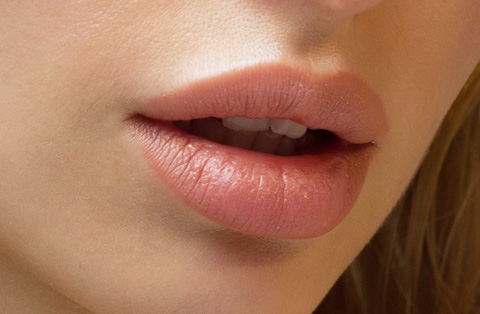 Cirugía Labial: Técnicas, Costos y Resultados